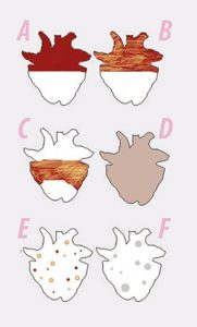 Anatomopathological diagnosis in porcine respiratory processes (part II)