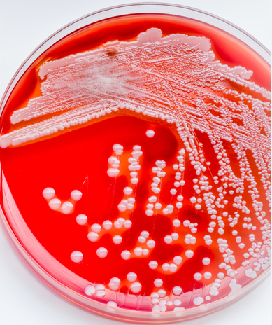 Las estreptococias porcinas que cursan con signos nerviosos
