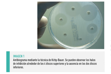 Técnicas de sensibilidad antibiótica: Aliadas del veterinario para ...