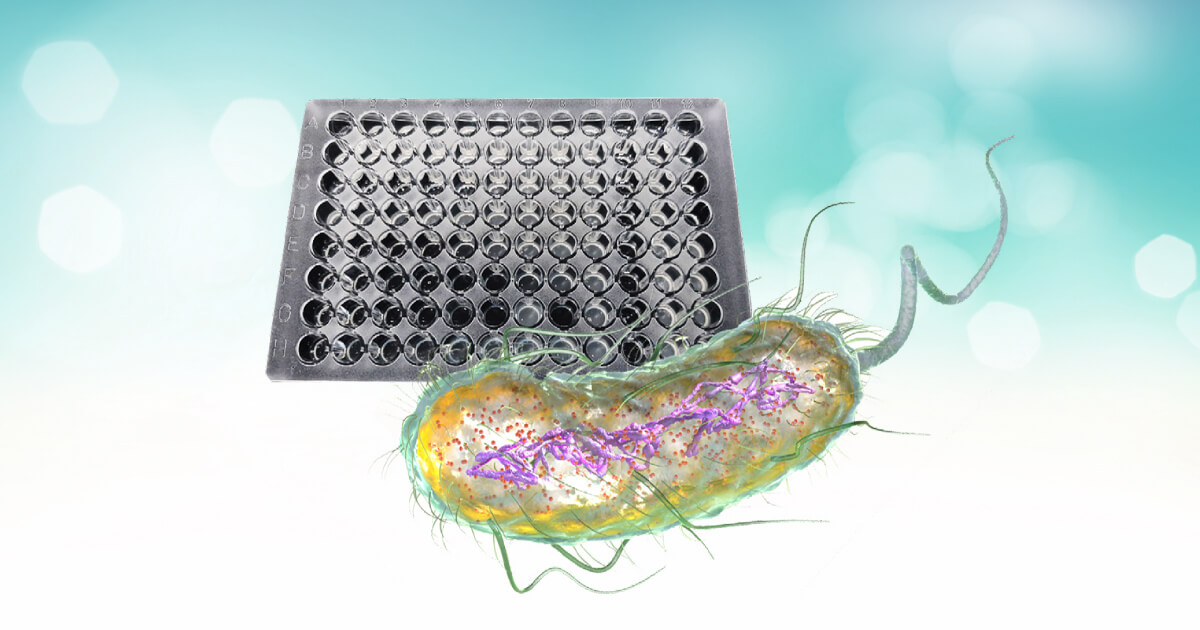 Sensibilidad antibiótica de E. coli en casos de diarrea postdestete