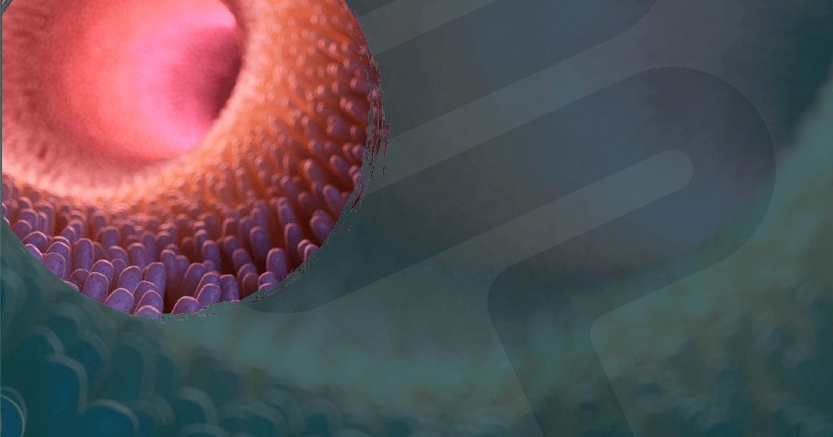 Salud Intestinal - ¿Qué es y por qué es importante?